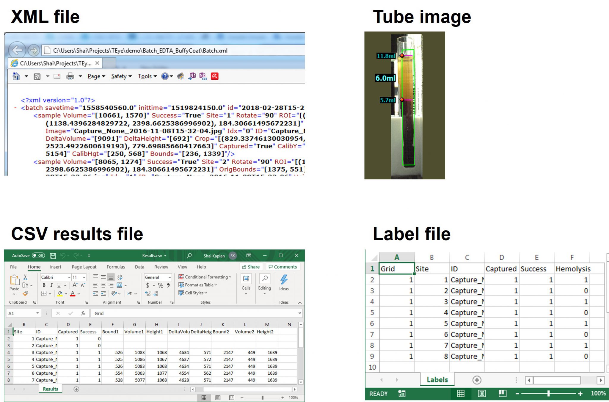 Blood fractionation and buffy coat extraction TubeEye - SciRobotics