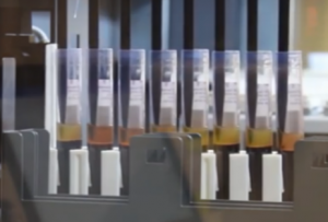 Blood fractionation and buffy coat extraction TubeEye - SciRobotics